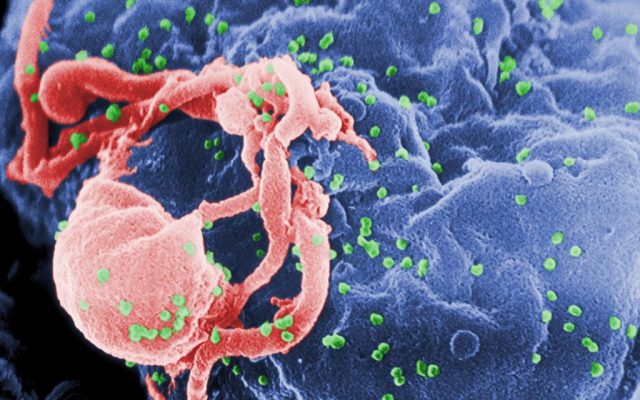 Australian research team announces possible ‘new pathway’ to curing HIV
